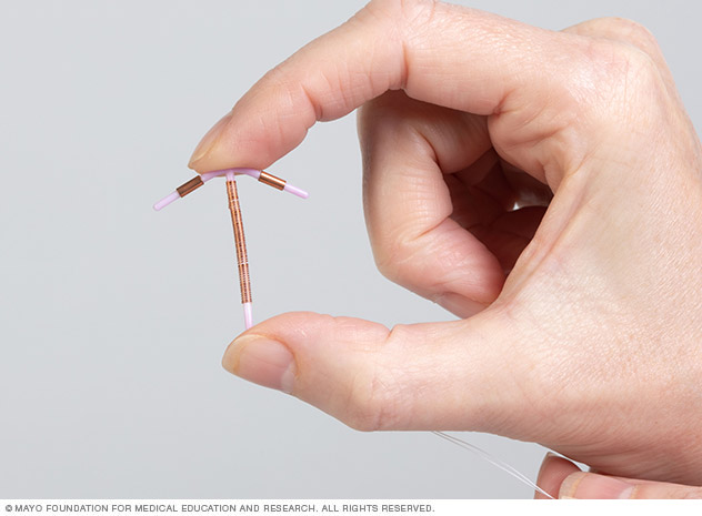 Copper IUD (ParaGard) | Beacon Health System