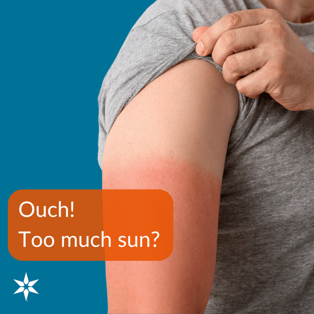 Sun safety: How to avoid sizzling this summer > Beacon Health System